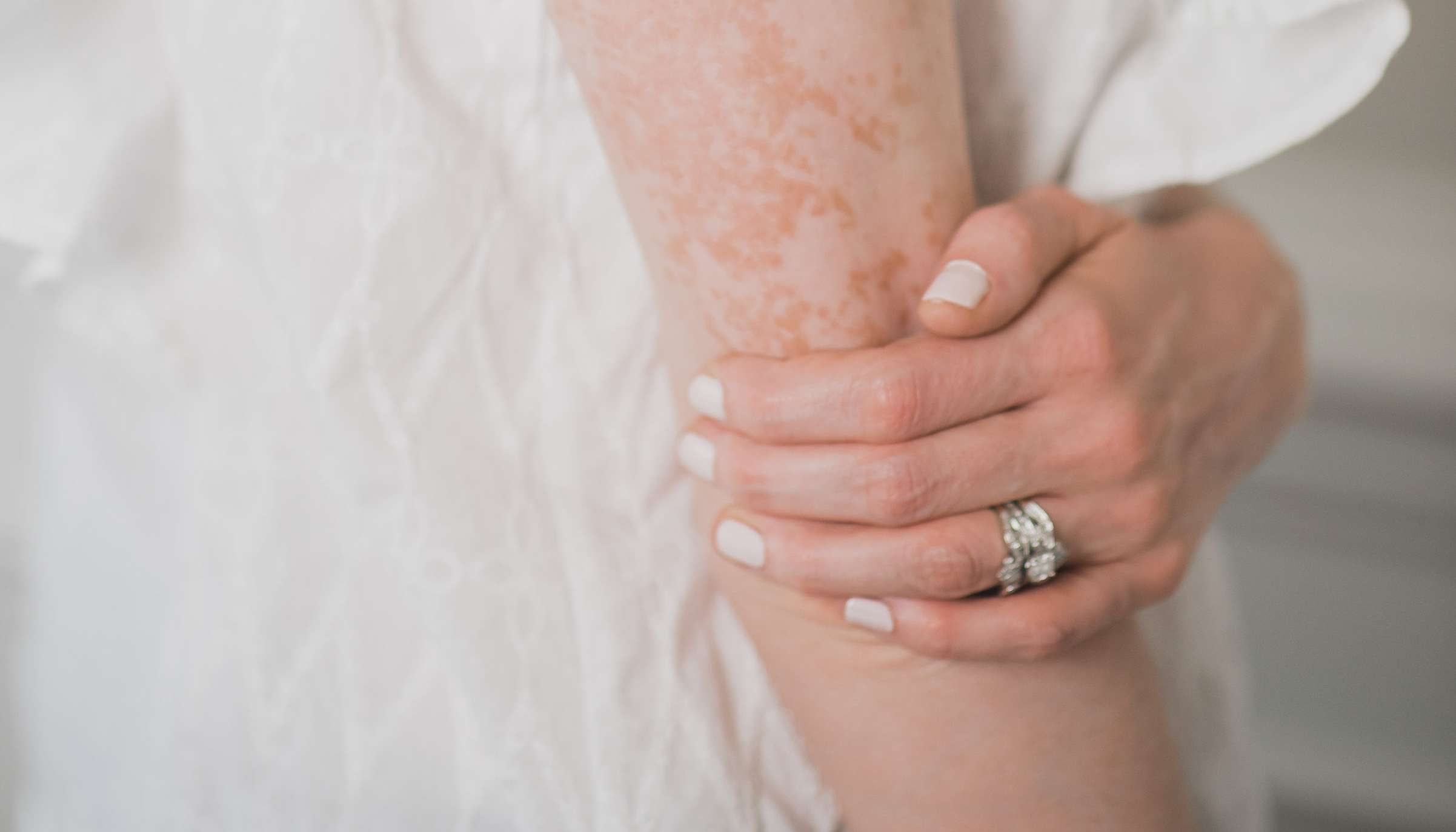 Your Skin is Beautiful: The Power of a Compliment